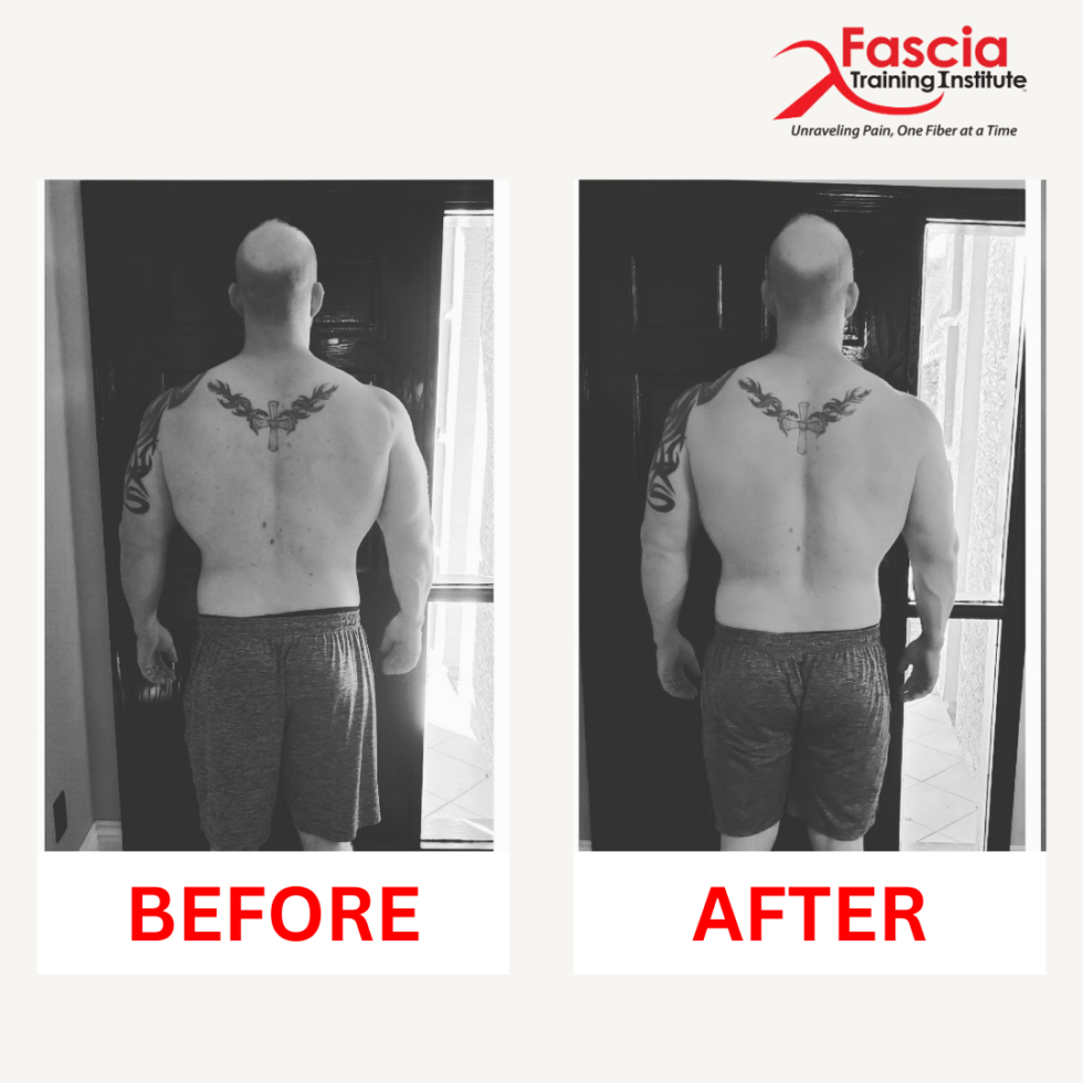Fascia Training Institute | Concussion Recovery, Brain Healing and ...