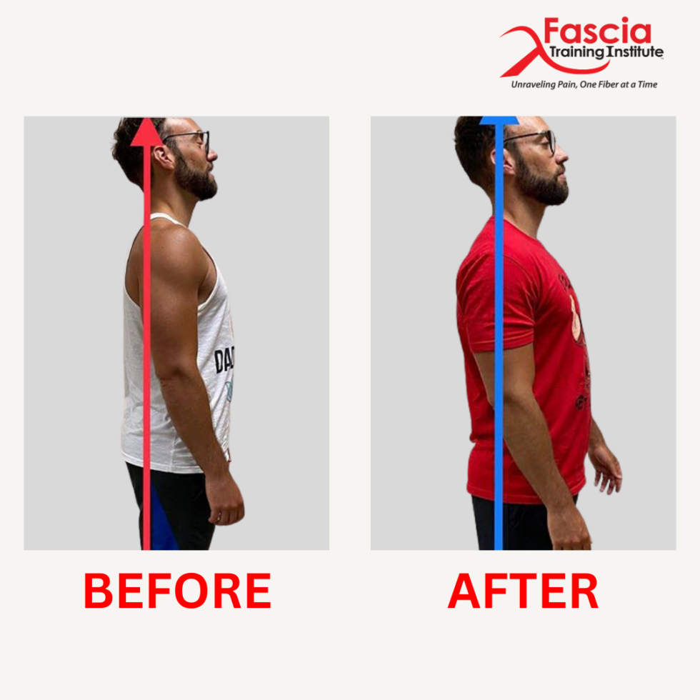 Fascia Training Institute | Concussion Recovery, Brain Healing and ...