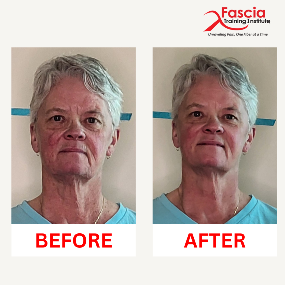 Fascia Training Institute | Concussion Recovery, Brain Healing and ...