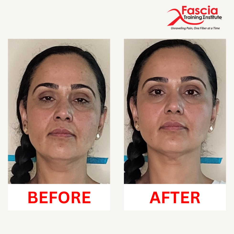 Fascia Training Institute | Concussion Recovery, Brain Healing and ...